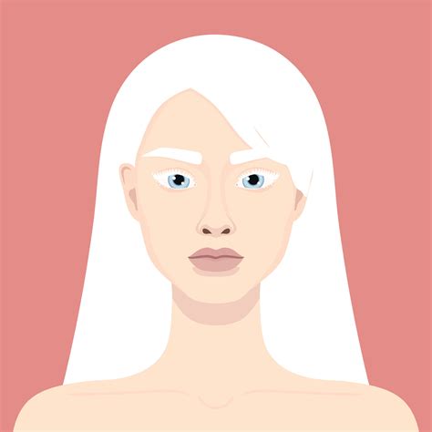 Albino Woman Portrait Avatar Of A Girl With Albinism Genetic Rare