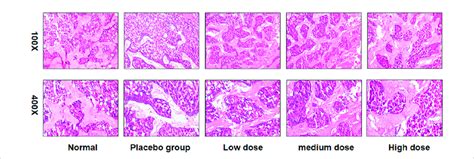He Staining Of Bone Tissue With Different Doses Of Drugs Download