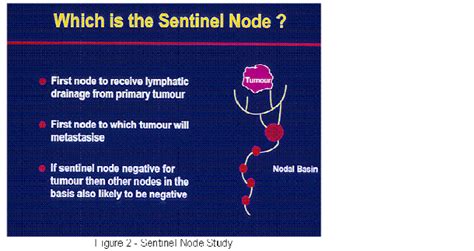 Melanoma And Skin Cancer Surgery And Sentinel Node Biopsy