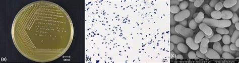 Colony Morphology A Cell Morphology B And Electron Microscopy
