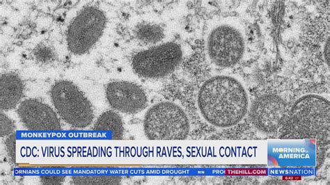 Cdc Virus Spreading Through Raves Sexual Contact Morning In America