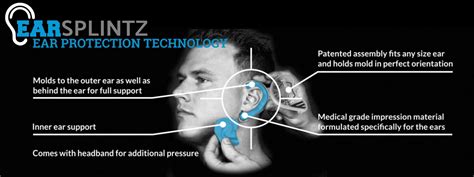 Earsplintz Cauliflower Ear Treatment Home