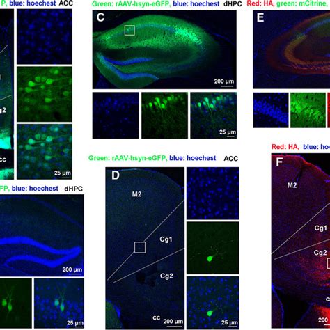 Implication Of Acc And Vhpc In Fear Generalization A Design Of The