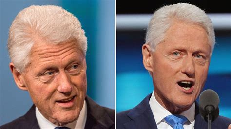 Bill Clinton Plastic Surgery Experts Weigh In The Hollywood Reporter