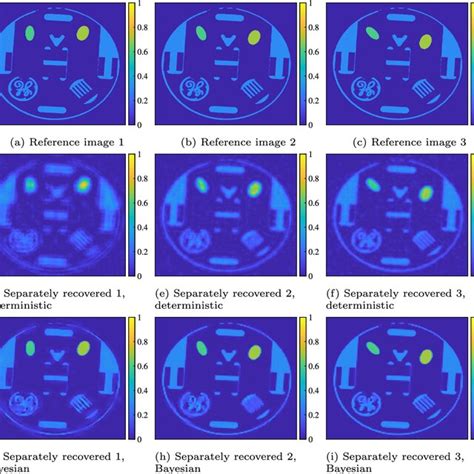 Three Temporal Phantom Images By A Ge Htxt 1 5t Clinical Mri Scanner Download Scientific