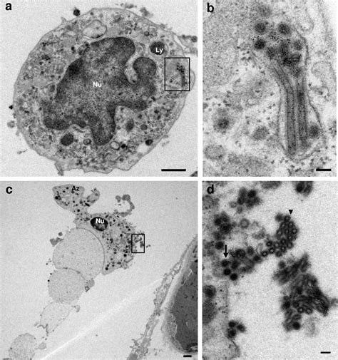 Electron Microscope Flu Virus