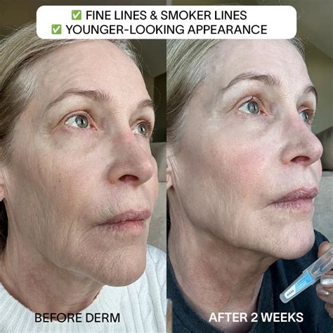 Transform Your Skin Professional Skincare Solutions Derm Skincare