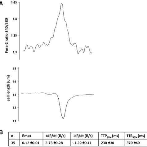 calcium transient analysis in induced pluripotent stem cell derived