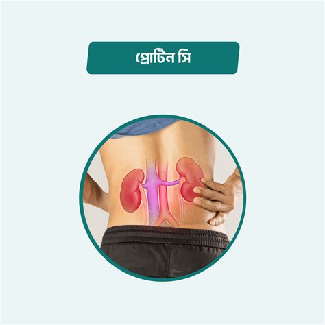 Protein C Arogga Online Lab