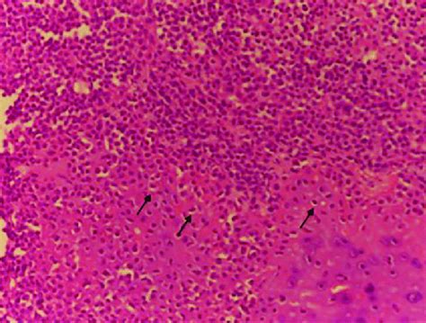 Chondroid Type Matrix With Chicken Wire Calcification Arrow He ×20 Download Scientific Diagram