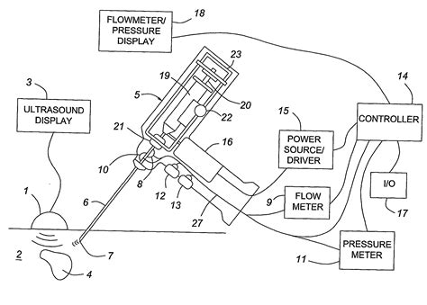 Ultrasonic Detection Patented Technology Retrieval Search Results Eureka Patsnap