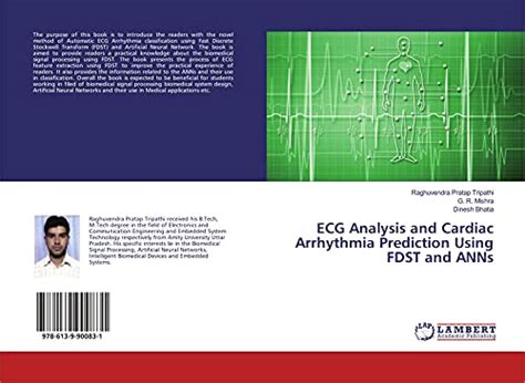Ecg Analysis And Cardiac Arrhythmia Prediction Using Fdst And Anns By