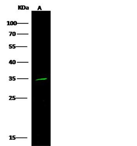 Alpha 1 Microglobulin Antibody Pa5 80336
