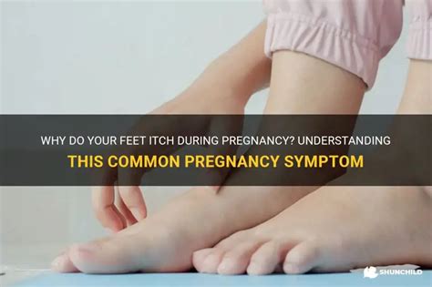 Why Do Your Feet Itch During Pregnancy Understanding This Common