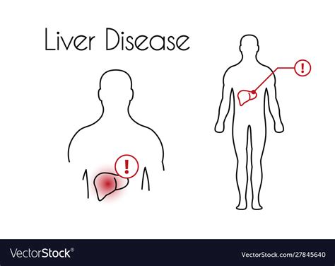 Liver Disease Linear Icon Young Man Royalty Free Vector
