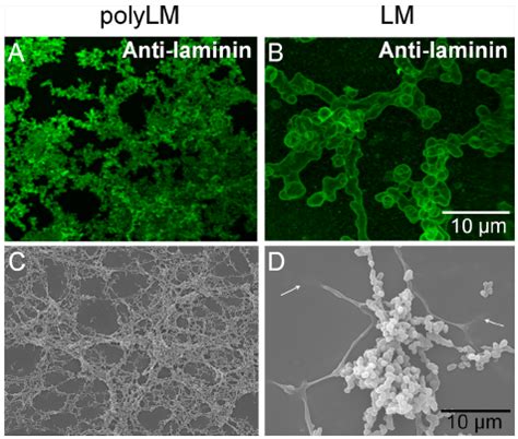 Three Dimensional Structure Of Laminin Polymers Under Confocal