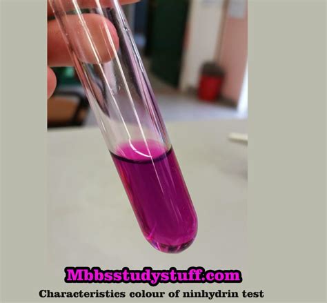 Ninhydrin Test Its Principle Reagents Procedure Etc Medical Study