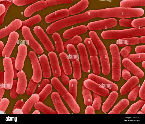 Coloured Scanning Electron Micrograph Sem Of Salmonella Typhi Is A