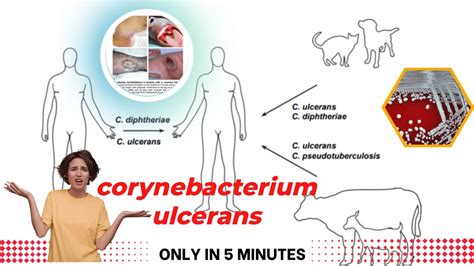 Corynebacterium Microbiology Lecture Corynebacterium Ulcerans Easy