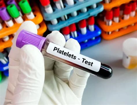Platelet Count Diagnostic Plus Platelet Count Diagnostic Plus