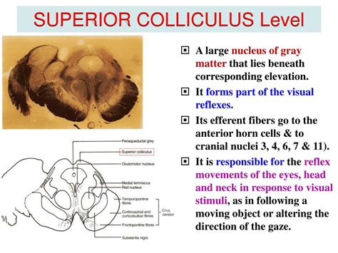 Ppt Brainstem 3 Powerpoint Presentation Free Download Id2114269