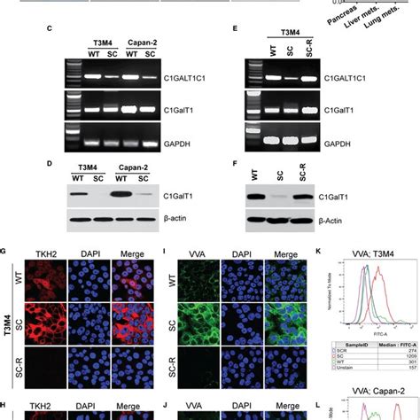 Stn Antigen Enhances Pdac Tumorigenicity A Ihc Analysis Of Stn Download Scientific Diagram