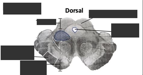 Midbrain Diagram Diagram Quizlet