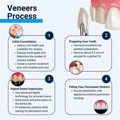The Porcelain Veneers Process