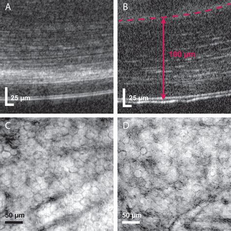 Unaffected Corneal Endothelial Cell Morphology A Single Download Scientific Diagram