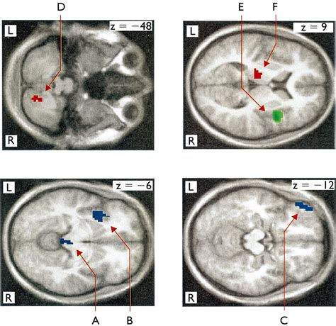 Parametric Responses Characterized By Positive Linear Red Negative