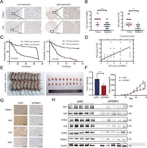 生物学一区tmt标记定量蛋白组学探究胃癌发展潜在机制