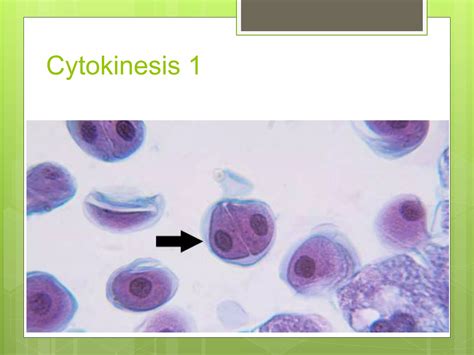 8 Slide Of Lily Anther 1 Meiosis Pptx