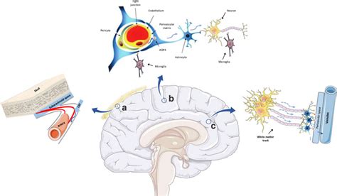 Neurovascular Glymphatic Dysfunction And White Matter Lesions Pmc
