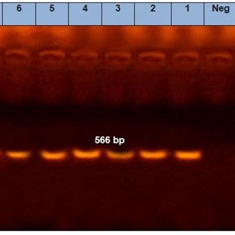 Enterococcus Faecalis Appear Under Microscope As Gram Positive Small Download Scientific