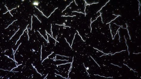 Dark Field Microscopy Bacteria