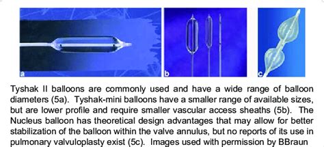 Tyshak Balloon Series Numed Download Scientific Diagram