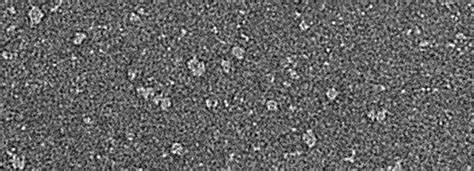 8 Tricks To Improve Your Negative Staining Of Membrane Proteins