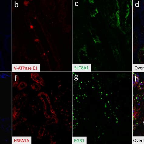 Hybrid Pcsics And Ic Subtypes Are Seen On Fluorescent Download