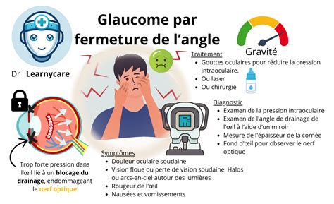 Glaucome Par Fermeture De Langle Dr Learnycare