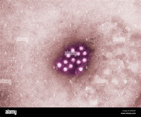 An Electron Micrograph Of The Hepatitis A Virus Hav An Rna Virus