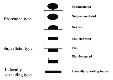 Morphological Classification Of Polyp By Kudo Classification