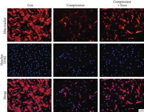 Bmsc Exos Protected Against Compression Induced Mitochondrial Damage In