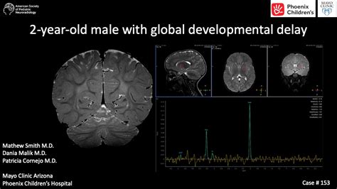 2 Year Old Male With Global Developmental Delay American Society Of