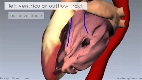 Aortic Vestibule Left Ventricle