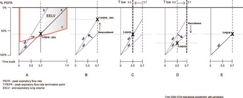End Expiratory Lung Volume Expiratory Flow Pattern During The Release Download Scientific
