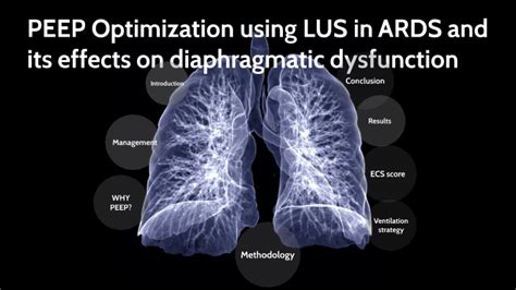 Peep Optimization Using Lus In Ards And Its Effects On Diaphragmatic