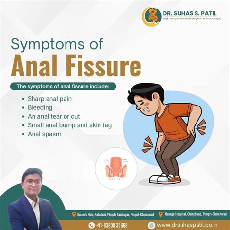 Anal Fissure Symptoms