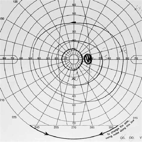 Left Eye Visual Field Download Scientific Diagram