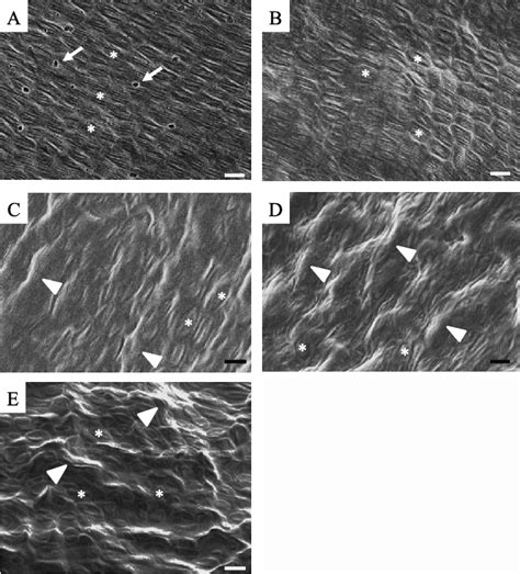 Structure Of The Aleurone Layer Surface Facing The Cotyledons In