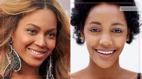 Types Of Nose Shapes Variations By Race And Ethnicity